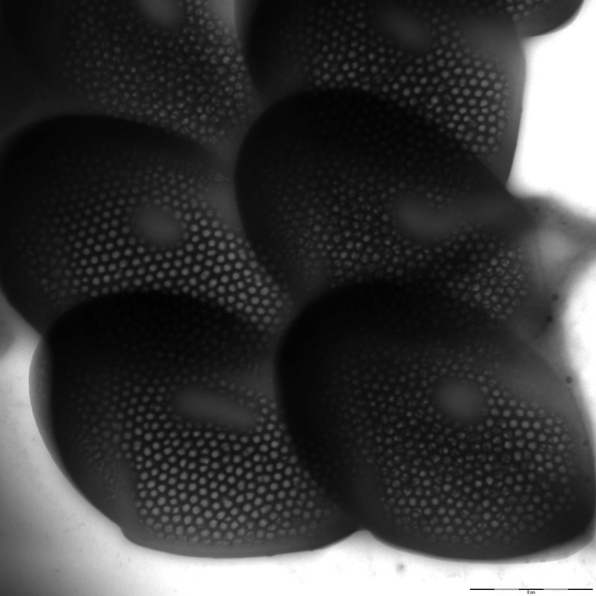 Mallomonas adamas | Silica-scaled chrysophytes of Europe